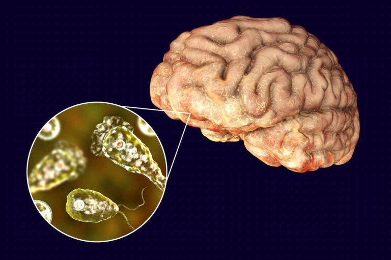 Brain-Eating Amoeba (Naegleria fowleri): Causes, Symptoms, and ...
